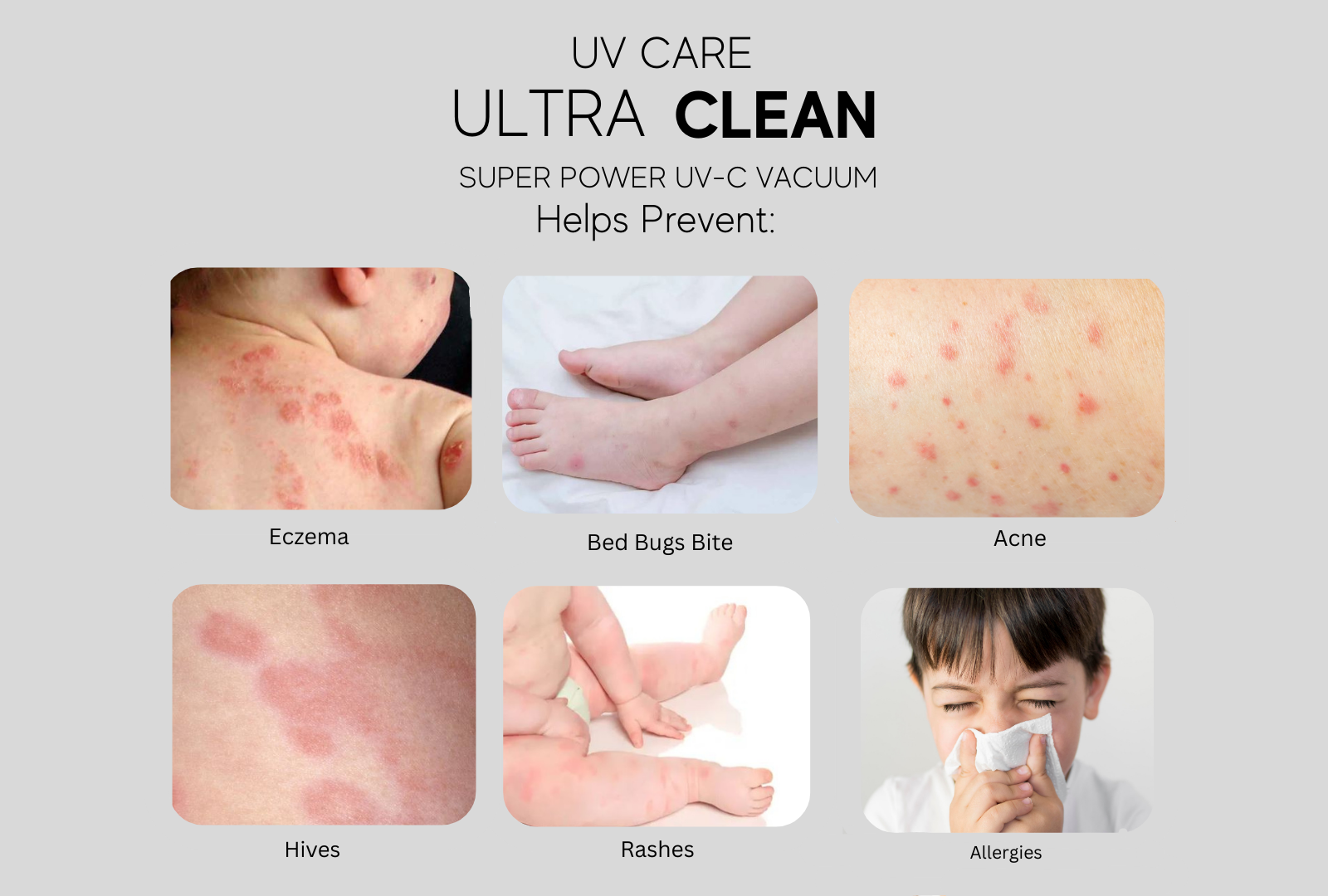 Vacuum Cleaner | UV-C Vacuum| UV Care